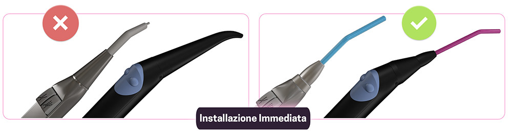 Starz Tipz Trial Kit - Zoom